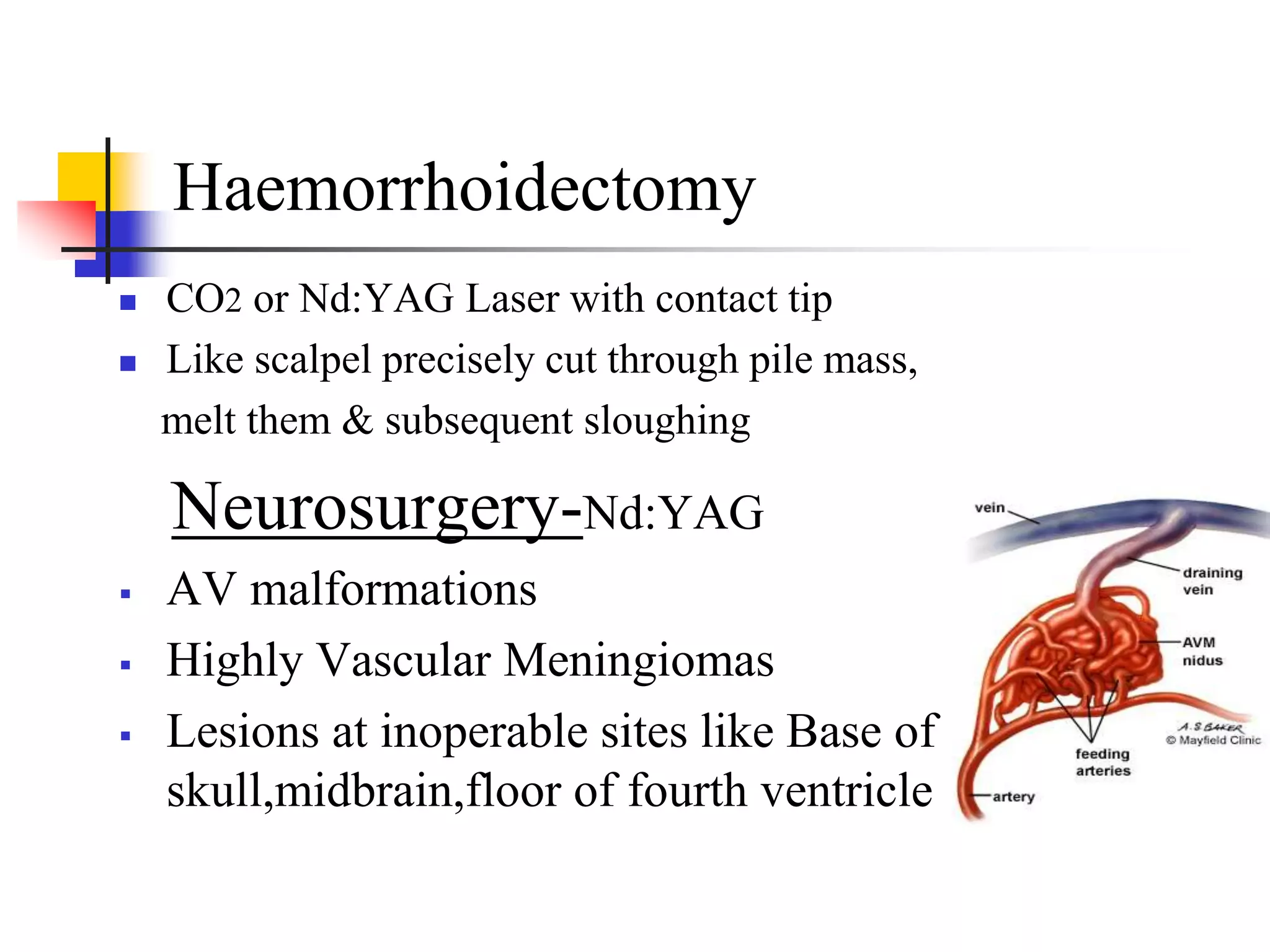 Lasers in surgery | PPTX