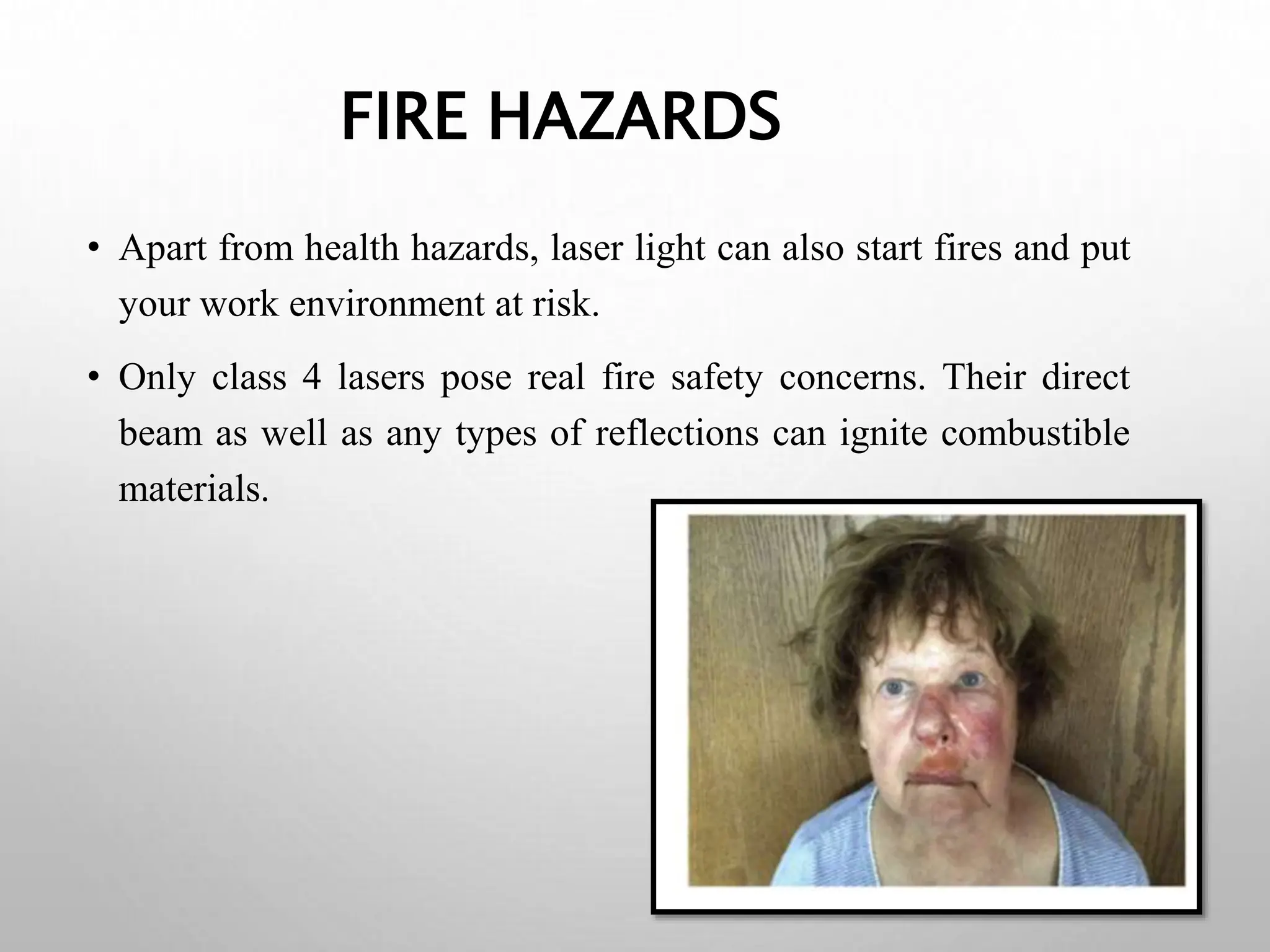 laser safety and hazards and their precautions.pptx