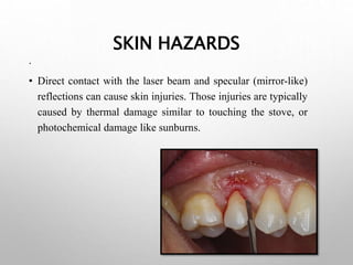 laser safety and hazards and their precautions.pptx