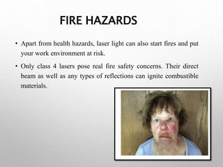 laser safety and hazards and their precautions.pptx