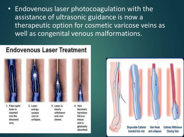 Lasers and their applications in plastic surgery | PPT