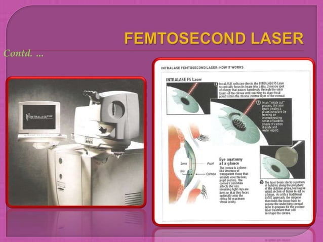 Lasers in ophthalmology | PPTX | Eye and Vision Conditions | Diseases ...
