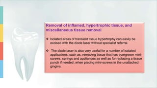 Lasers in dentistry | PPTX