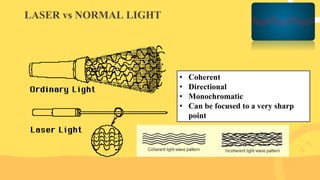 Lasers in Dentistry | PPTX