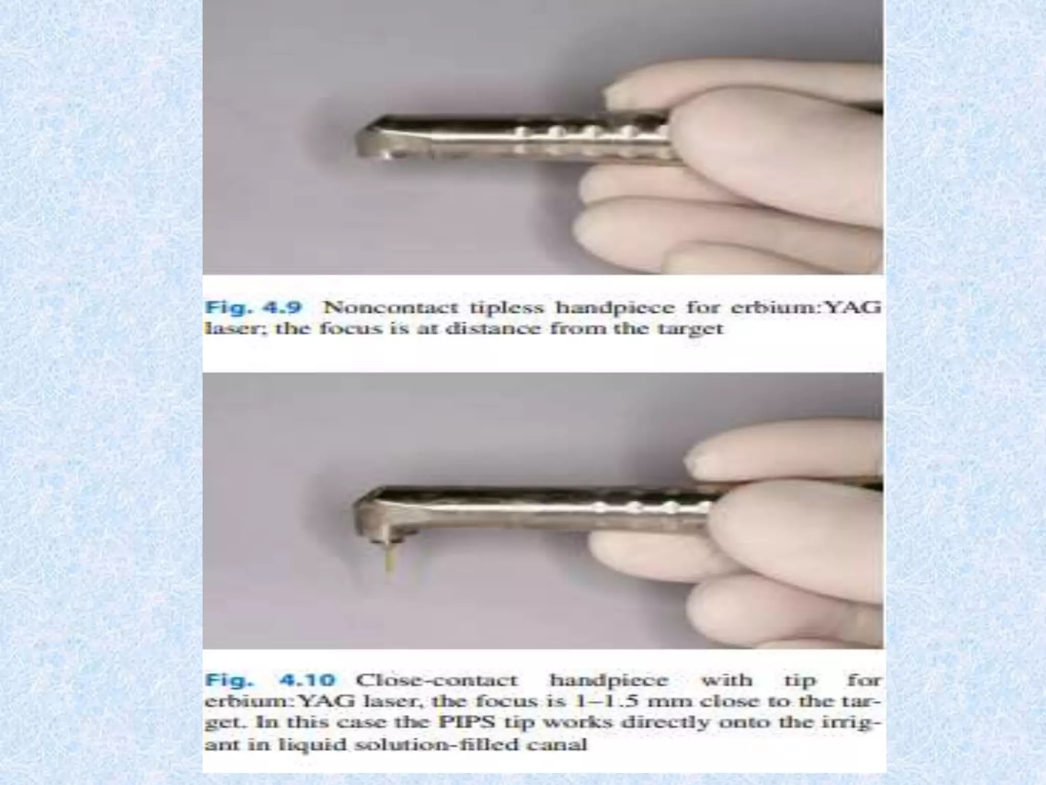 LASERS IN ENDODONTICS | PPTX