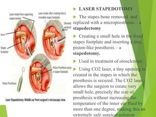 LASERS IN ENT ppt. (1).pptx