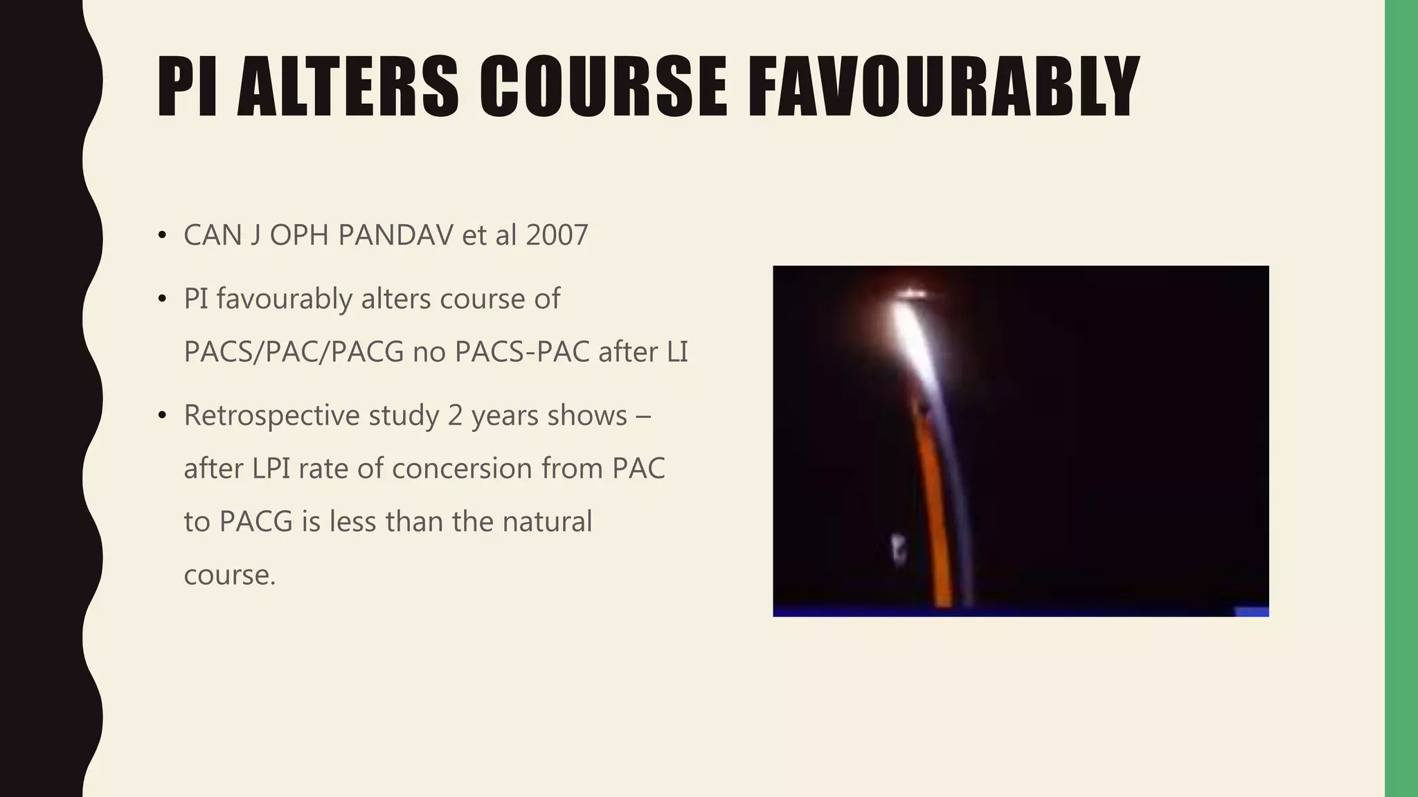 Lasers in glaucoma.pptx
