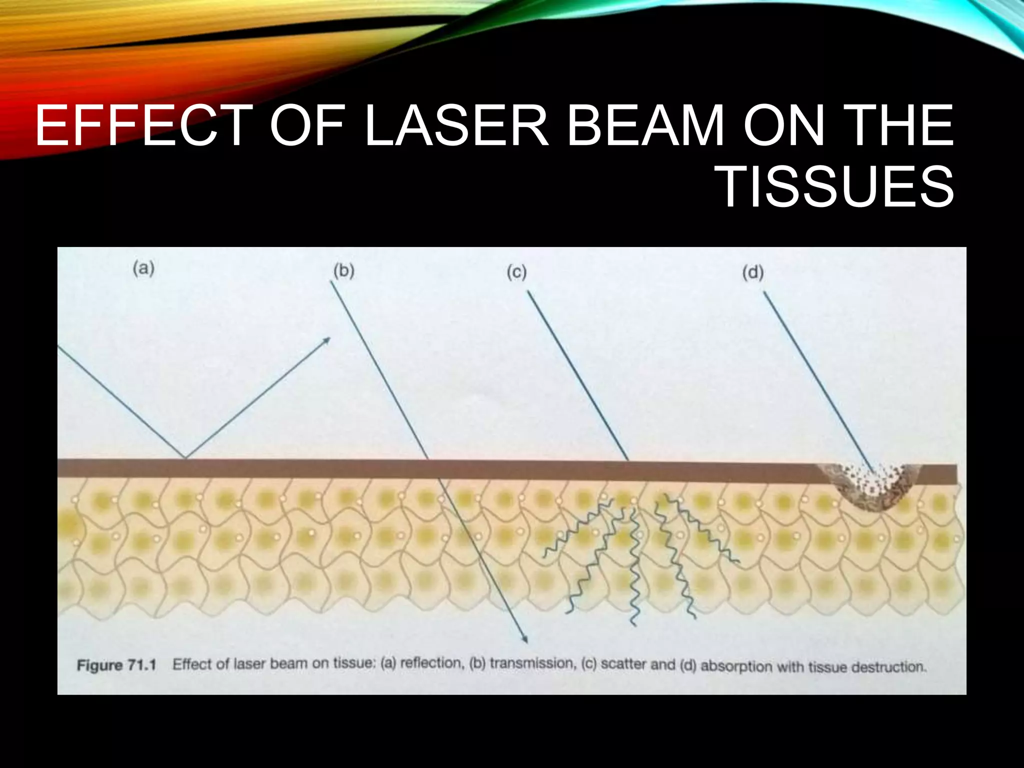 Lasers in medicine, basic principles and application | PPTX