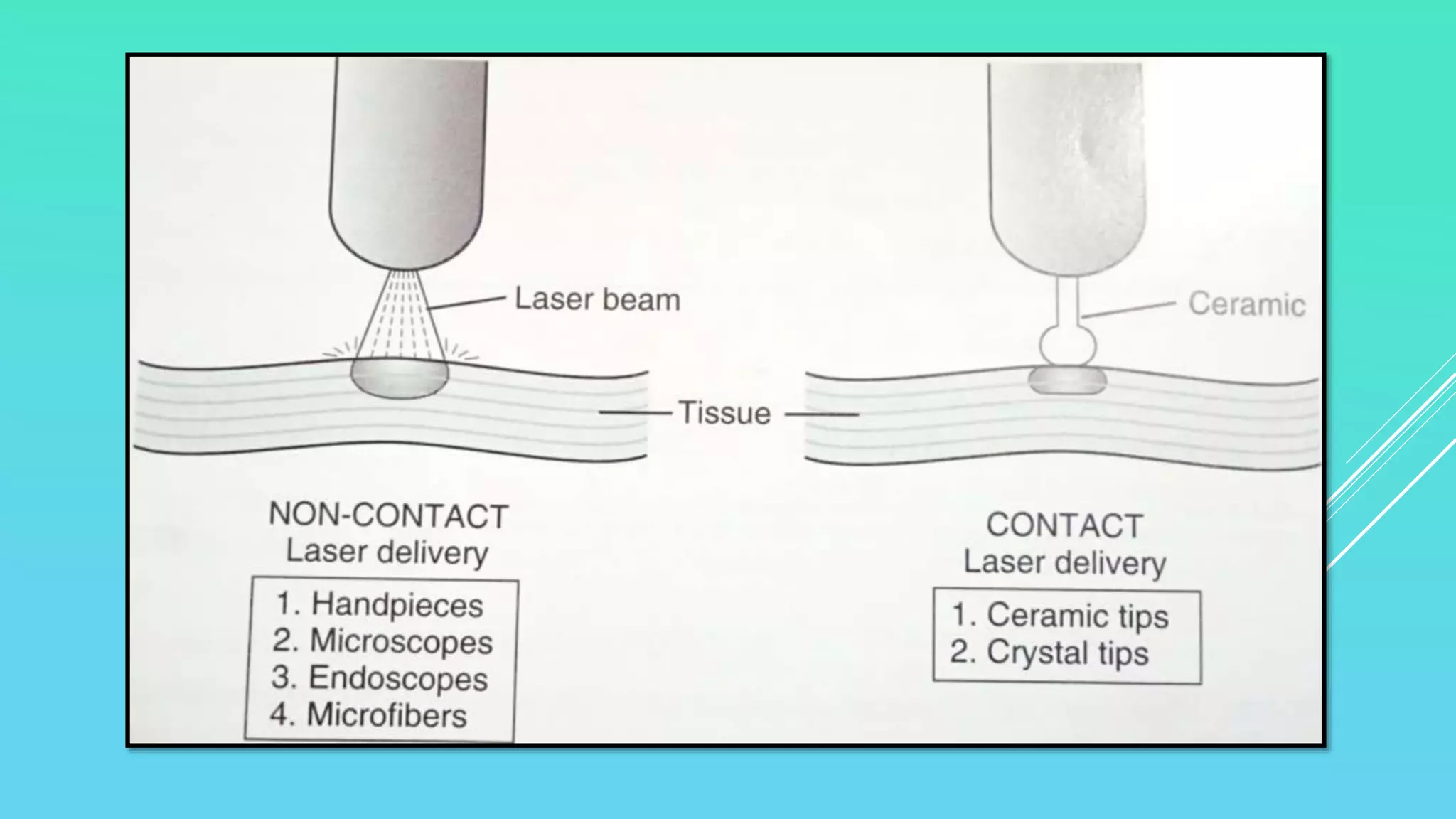 LASERS in OMFS | PPTX