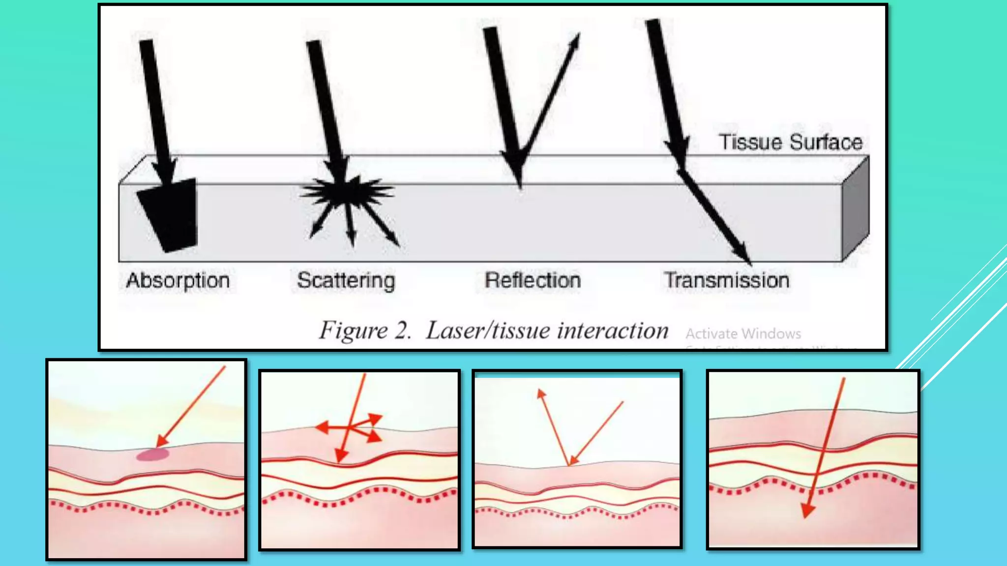 LASERS in OMFS | PPTX