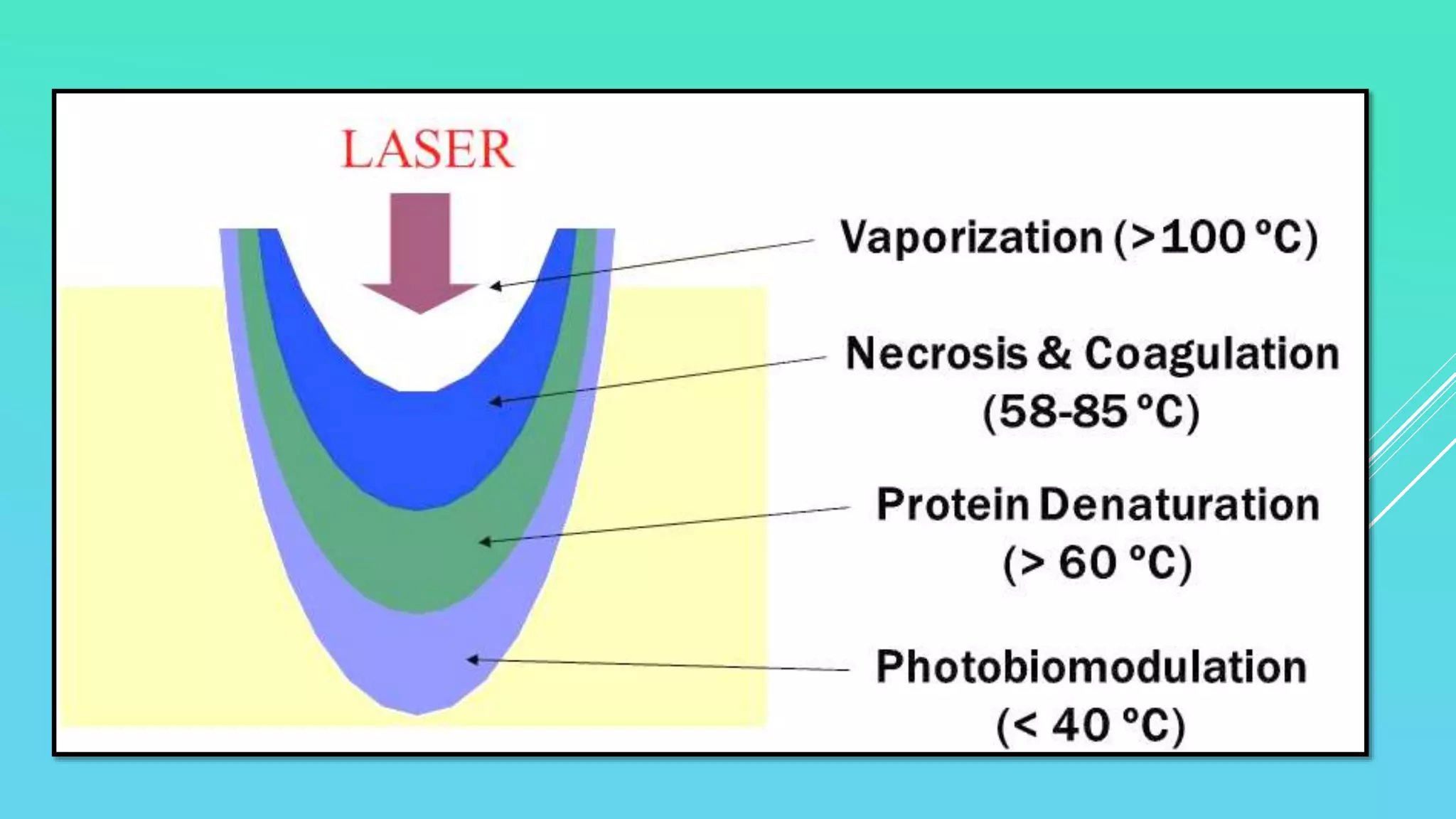 LASERS in OMFS | PPTX