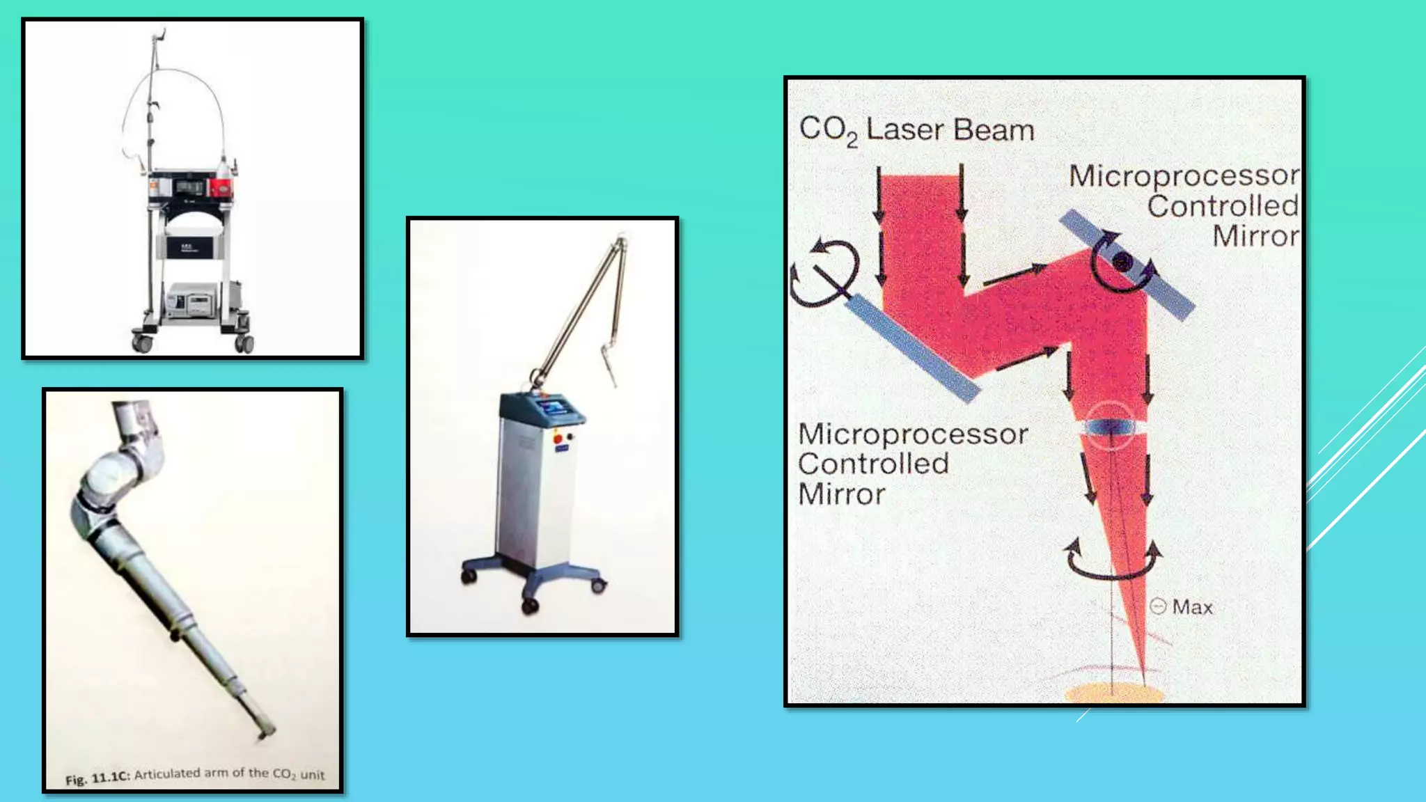 LASERS in OMFS | PPTX