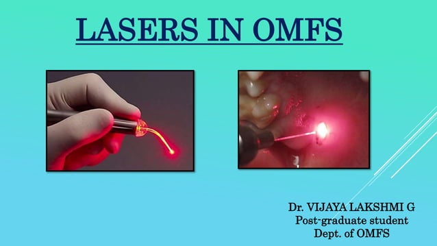 LASERS in OMFS | PPTX