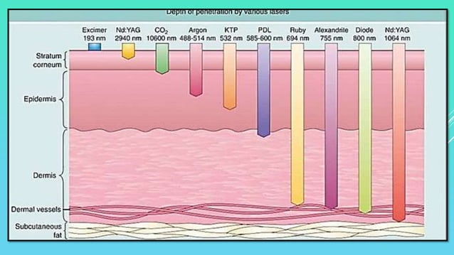 LASERS in OMFS | PPTX