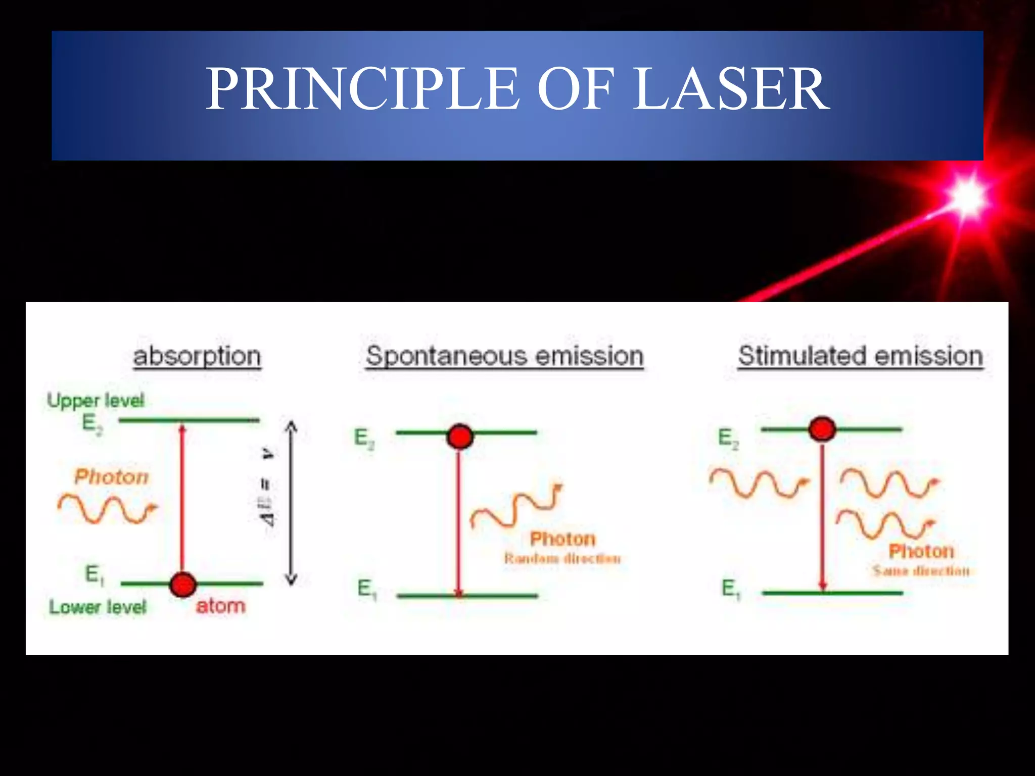 Lasers in operative dentistry seminar ppt | PPTX