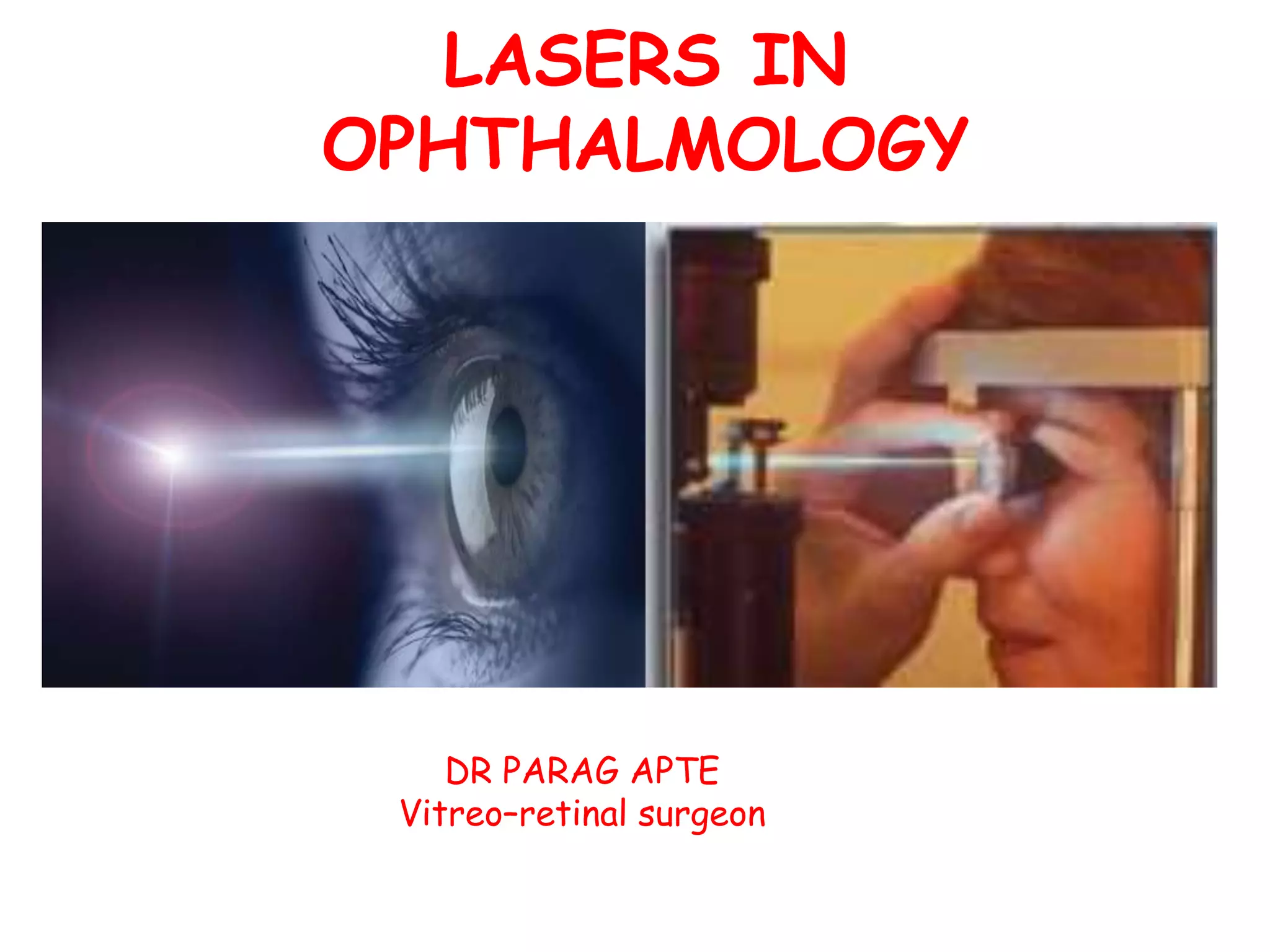 Lasers in ophthalmology - Dr. Parag Apte | PPTX
