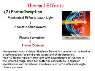 Lasers in ophthalmology - Dr. Parag Apte | PPTX