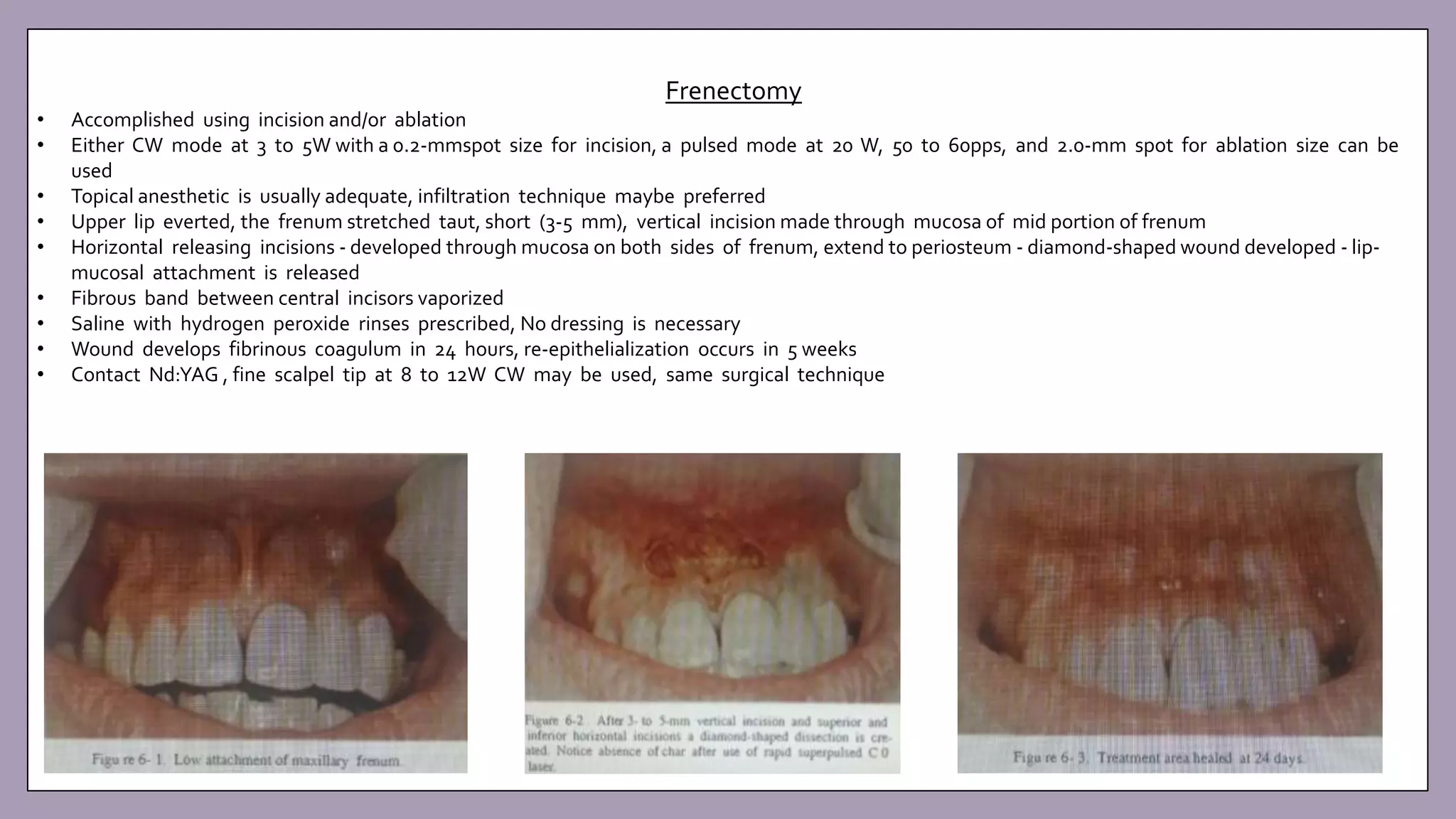 Lasers in oral and maxillofacial surgery | PPTX