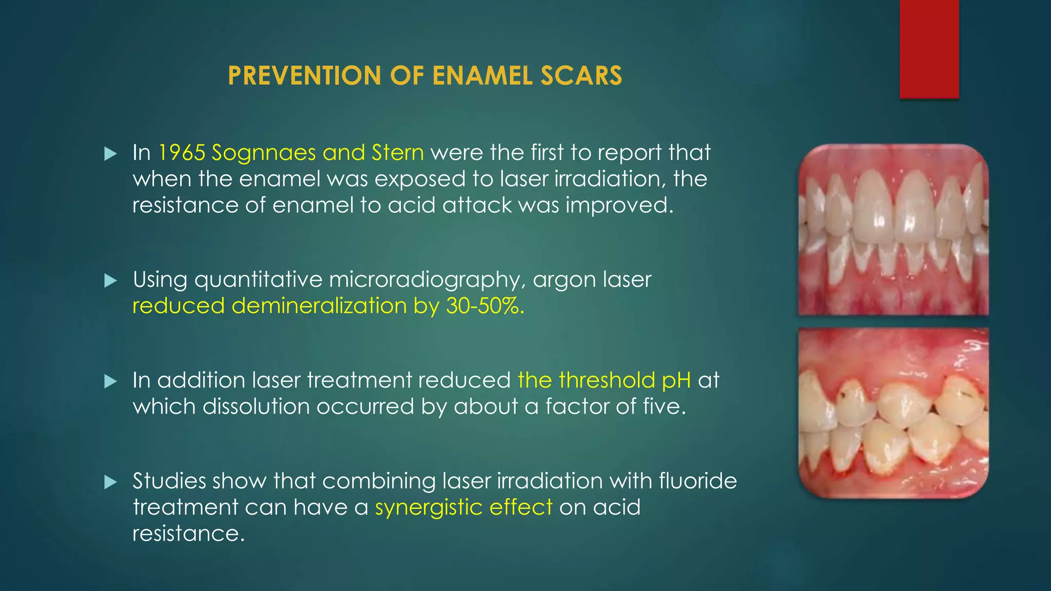 Lasers in orthodontics.pptx new | PPTX
