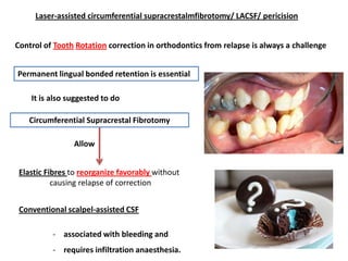 Lasers in Orthodontics - Dr. Nabil Al-Zubair | PPT