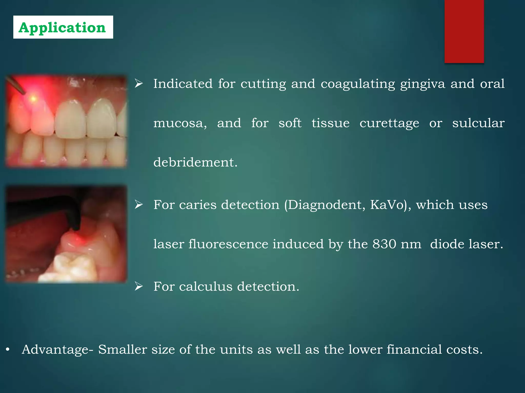 Lasers in periodontics | PPTX