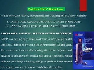 Lasers in periodontics | PPTX