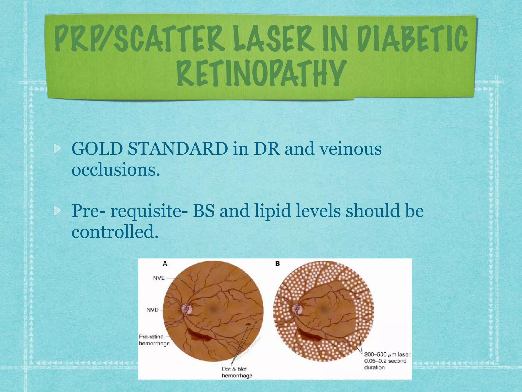 LASERS IN RETINA | PDF