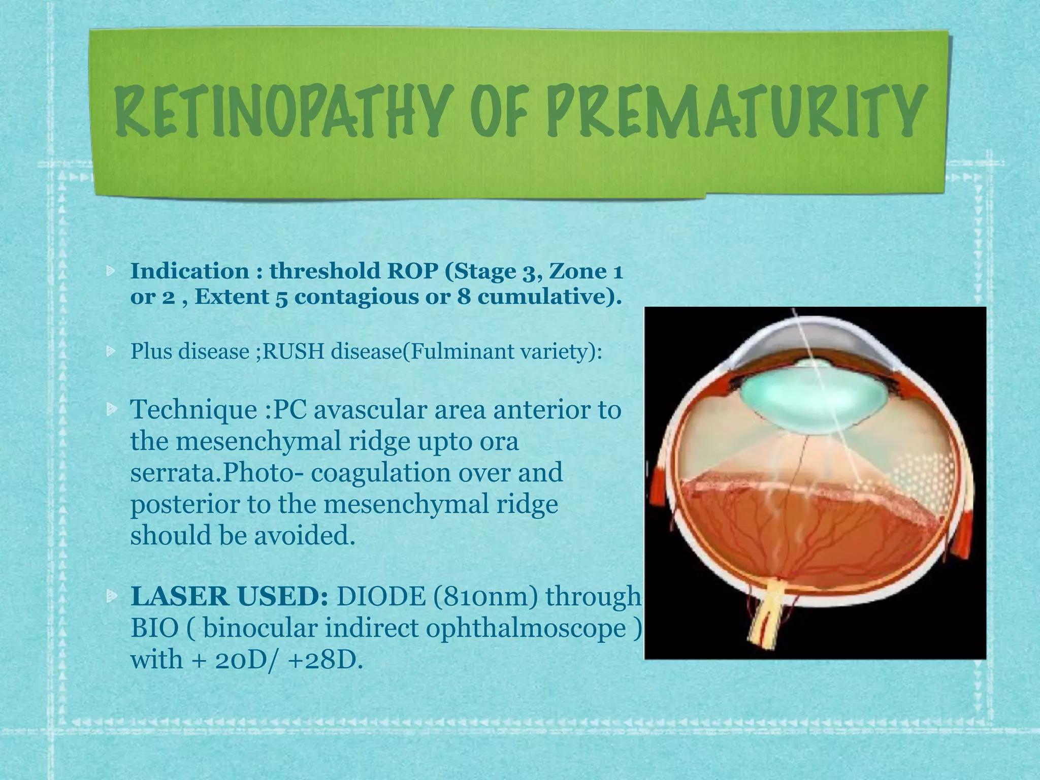 LASERS IN RETINA | PDF