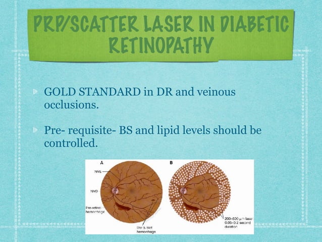 LASERS IN RETINA | PDF | Eye and Vision Conditions | Diseases and ...