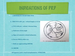 LASERS IN RETINA | PDF | Eye and Vision Conditions | Diseases and ...