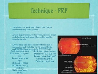 LASERS IN RETINA | PDF
