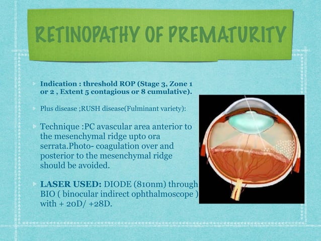 LASERS IN RETINA | PDF | Eye and Vision Conditions | Diseases and Conditions
