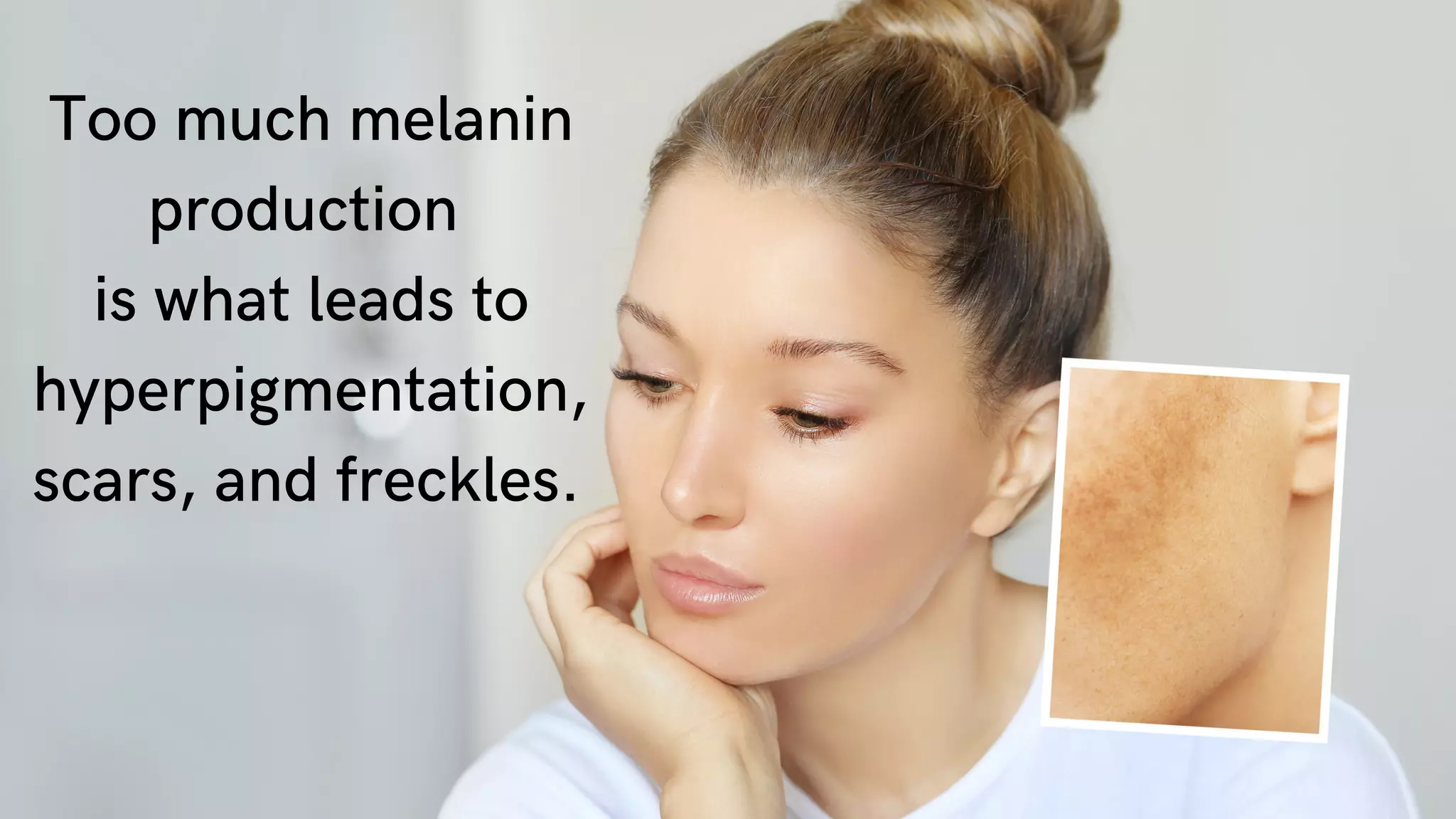 Laser Skin Lightening | PPT