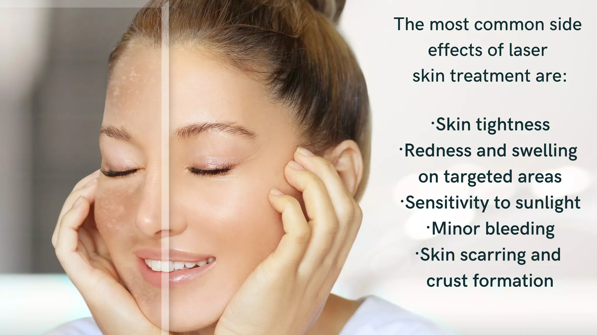 Laser Skin Lightening | PPT