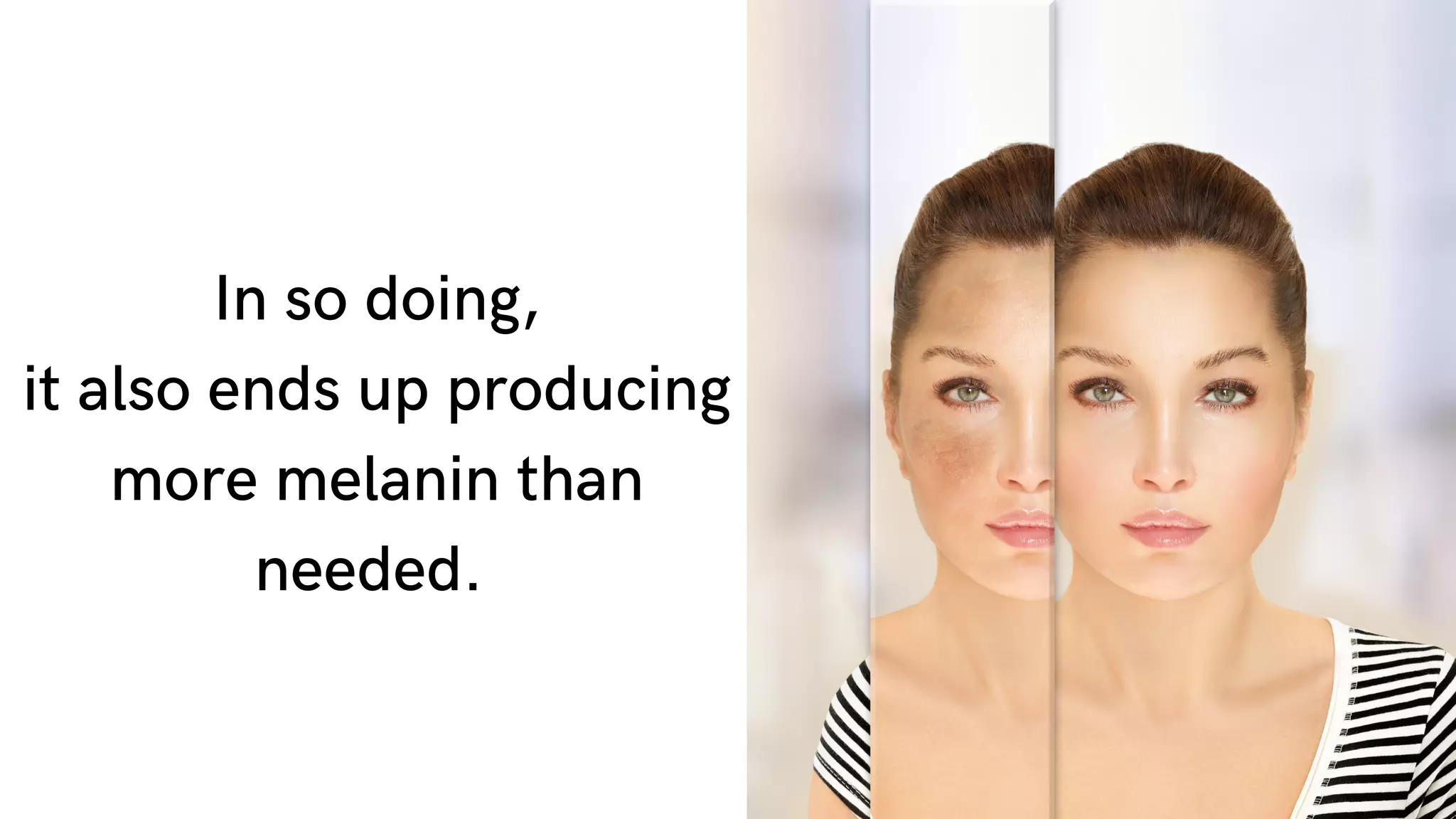 Laser Skin Lightening | PPT