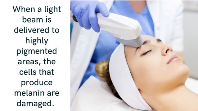 Laser Skin Lightening | PPT