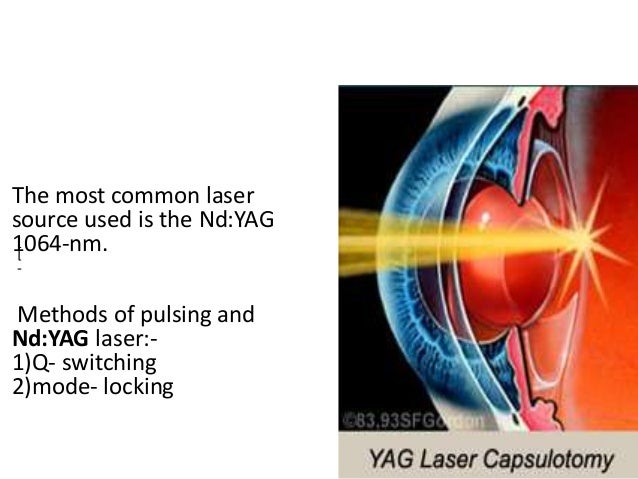 Basics Of Lasers