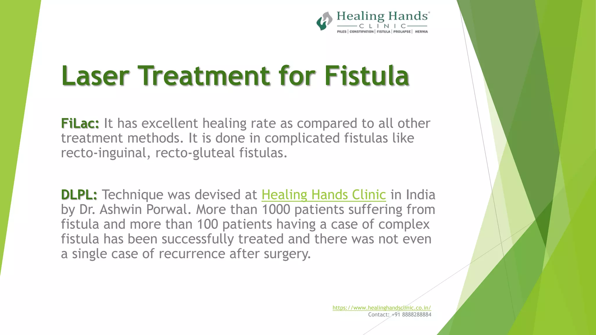 Laser Surgery for Fistula | PPTX