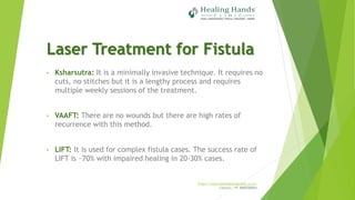 Laser Surgery for Fistula | PPTX