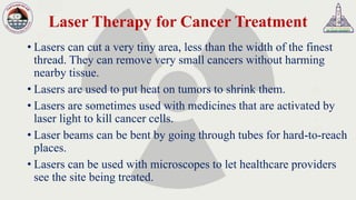 Laser Light in Cancer Therapy | PDF