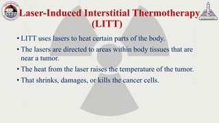 Laser Light in Cancer Therapy | PDF