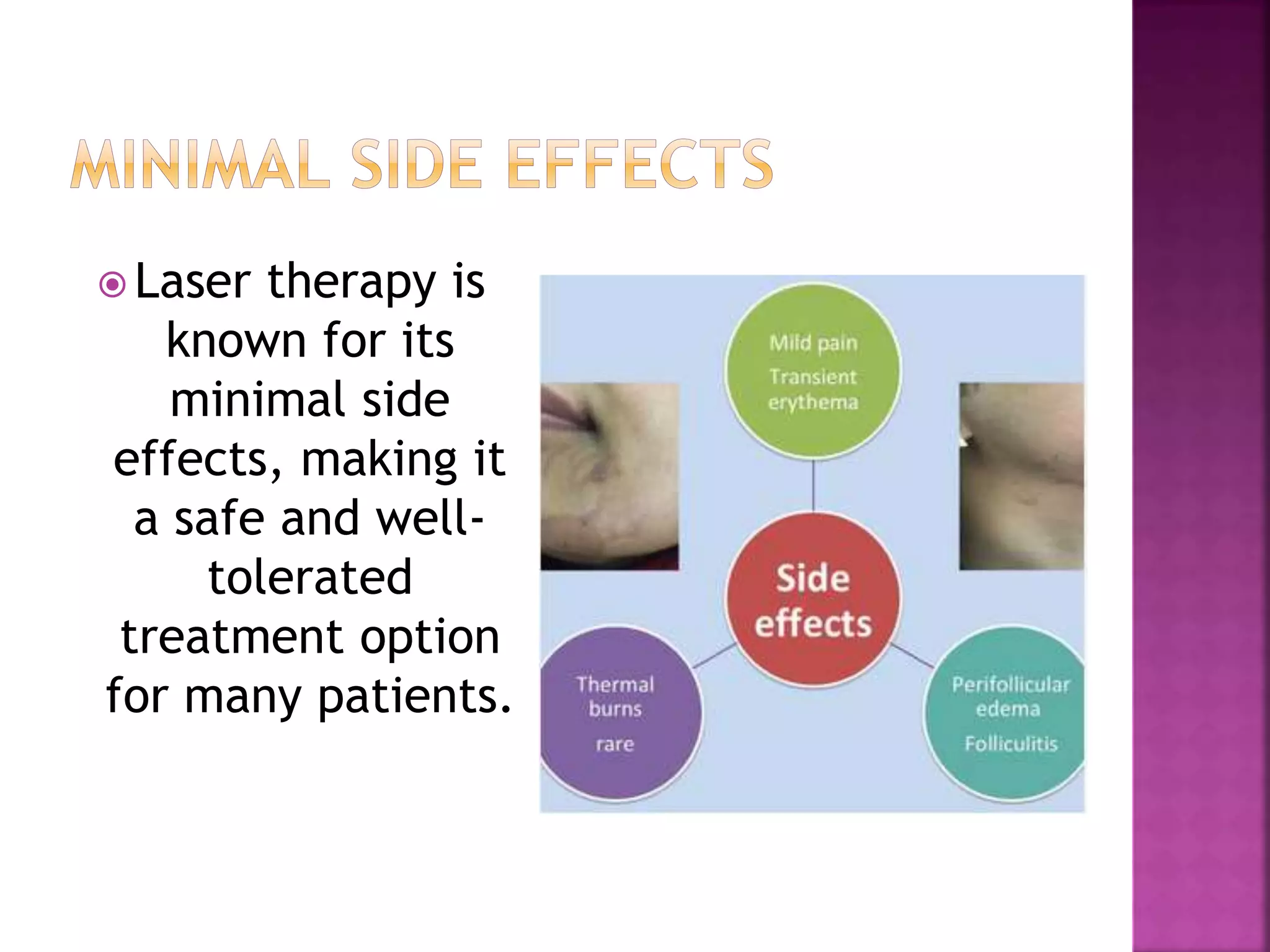 Laser Therapy in Halifax.pptx