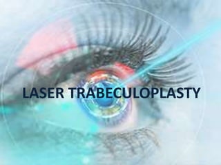 Selective Laser Trabeculoplasty