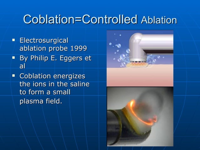 Laser Versus coblator | PPT