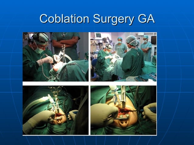 Laser Versus coblator | PPT