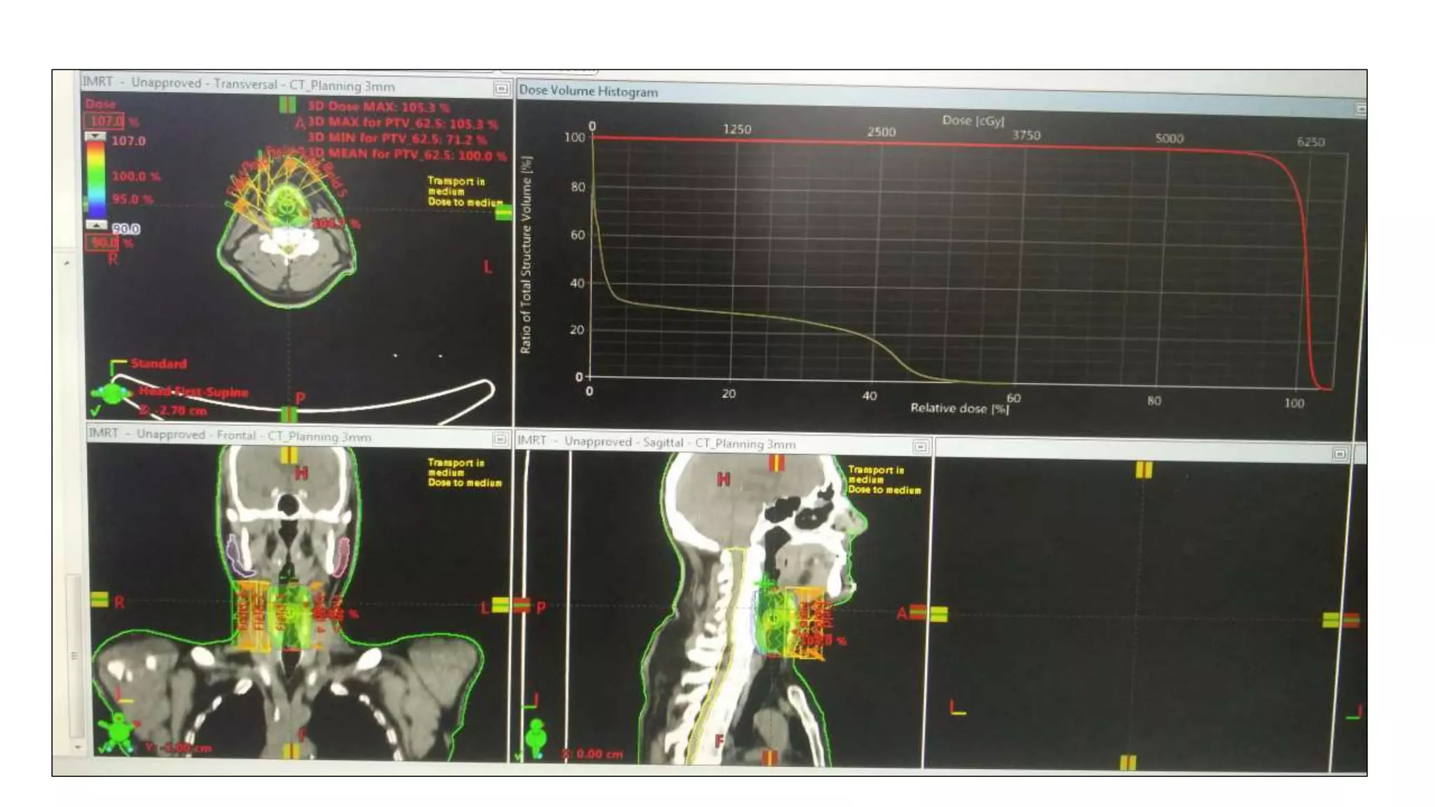 Laser vs radiation in early laryngeal SCC | PPT