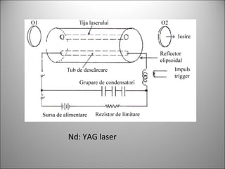 Laser yag | PPT