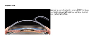 LASIK is a type of refractive eye surgery | PDF