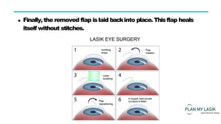 Lasik-Laser-Eye-Surgery.pdf