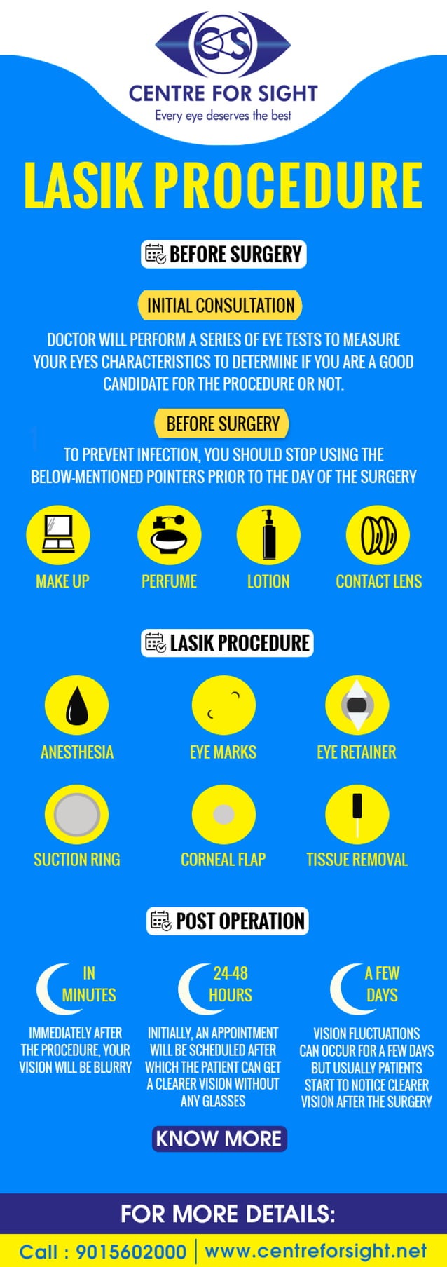 Lasik procedure | PDF